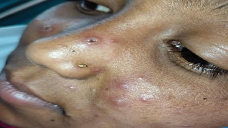 Headline Nepal : Online News Portal | How Many Students Are Seen ...